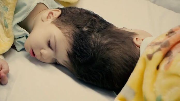 Gemelos brasileños unidos por su cerebro, tuvieron la cirugía que tanto ...